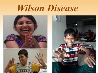 seminar wilson disease in Paediatrics population | PPTX