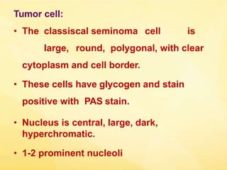 seminoma-190909130212.pptx