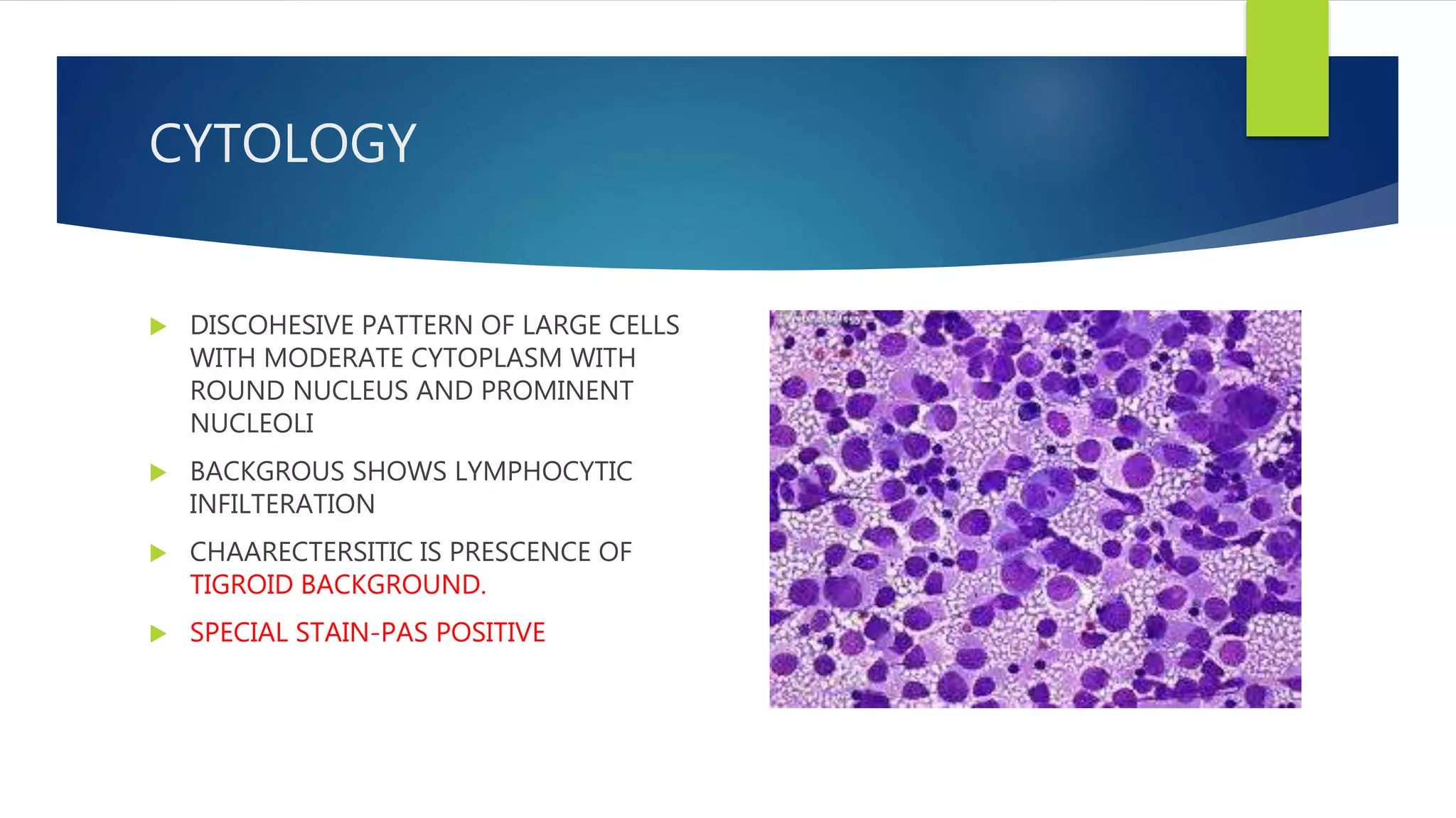 Testicular tumors-germ cell tumor-seminoma | PPTX
