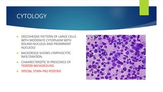 Testicular tumors-germ cell tumor-seminoma | PPT