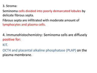 SEMINOMA.pptx ........................... | PPTX