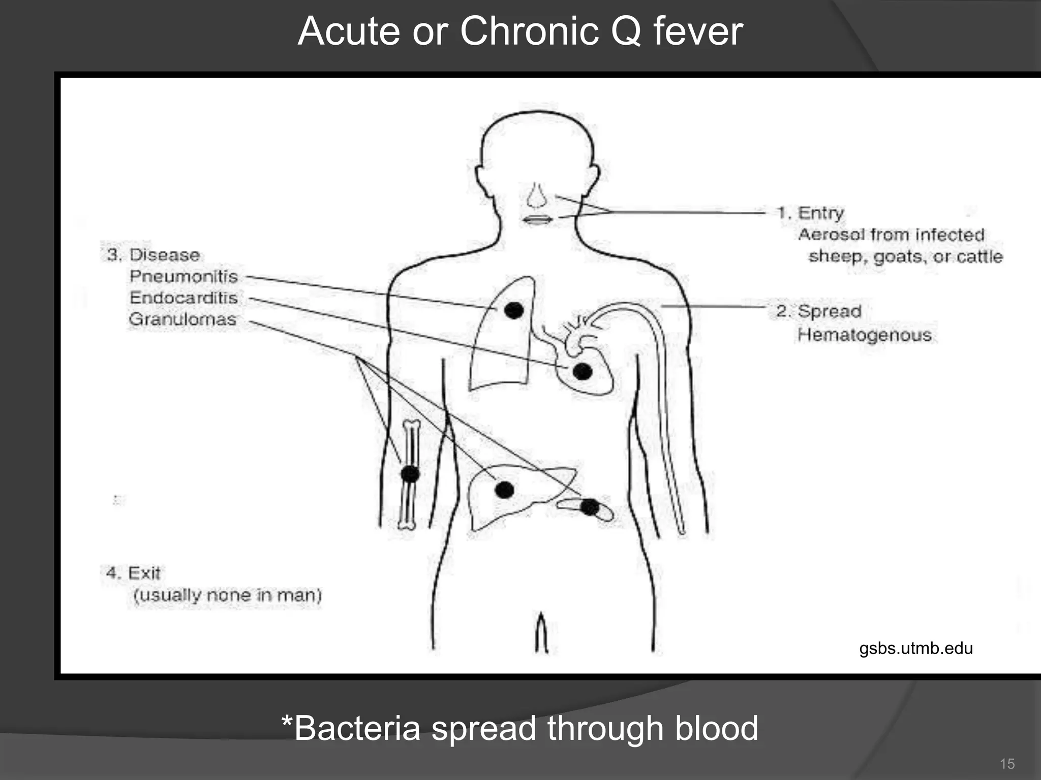 Q-fever | PPTX
