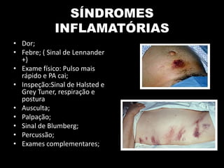 Abdome agudo | PPTX