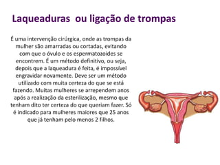Seminário métodos contraceptivos 8 ano | PPTX