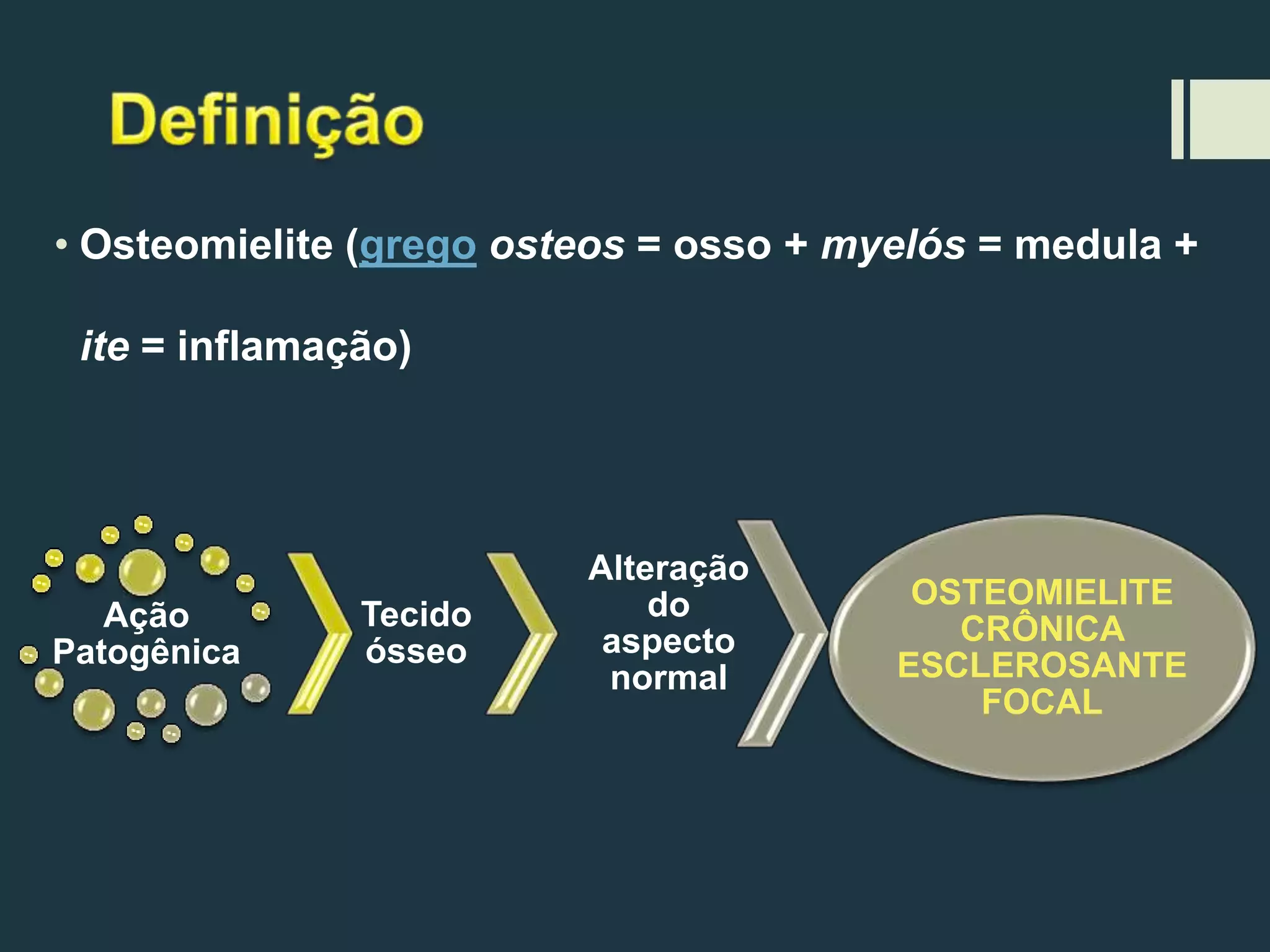 Osteomielite crônica esclerosante focal