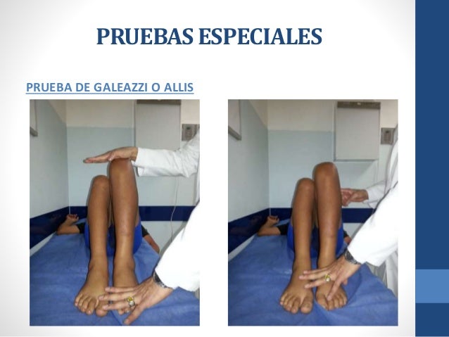 Semiogia de cadera - Ortopedia y Traumatologia