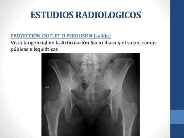 Semiogia de cadera - Ortopedia y Traumatologia