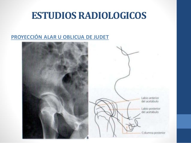 Semiogia de cadera - Ortopedia y Traumatologia