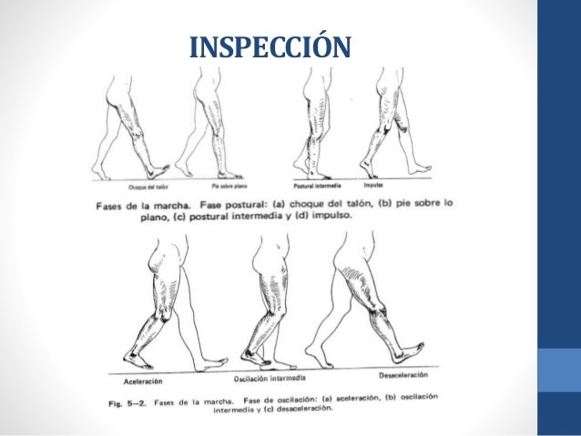 Semiogia de cadera - Ortopedia y Traumatologia