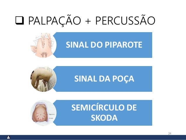 Derrame Peritoneal (Ascite) - Semioliga UFMT
