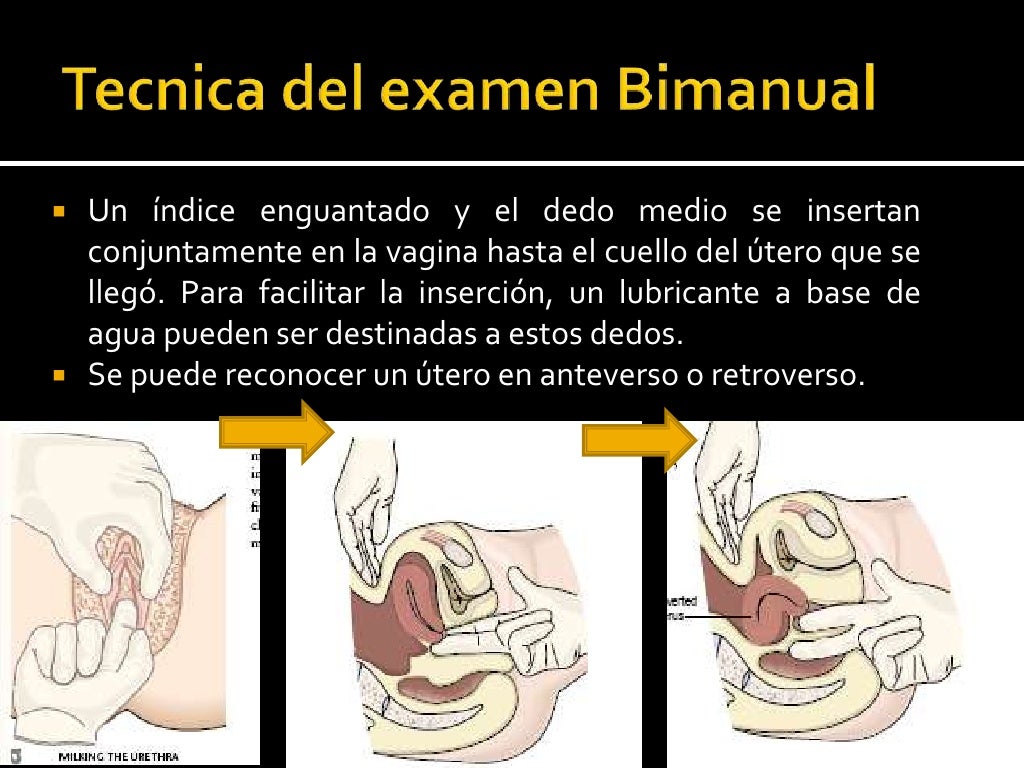 Semiología Aparato Genital Femenino Examen Ginecologico
