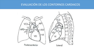 Semiología cardiaca | PPTX