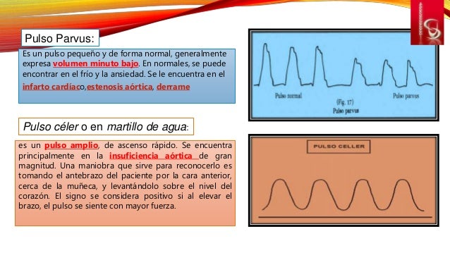 SEMIOLOGIA CARDIACA
