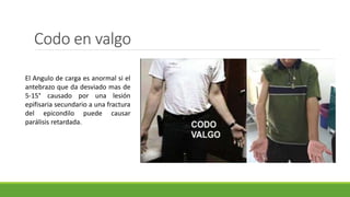 semiología y patologías del codo | PPTX