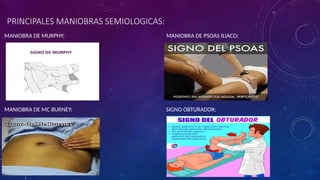 Semiología del abdomen por cuadrantes, examen fisico. | PPTX