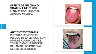 SEMIOLOGÍA DE LA CAVIDAD ORAL Y LA FARINGE.pptx