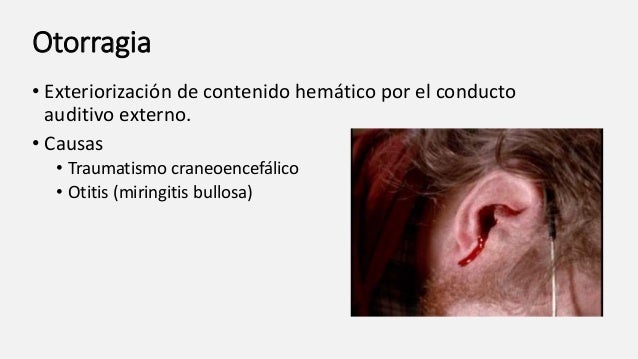 Semiología del aparato auditivo