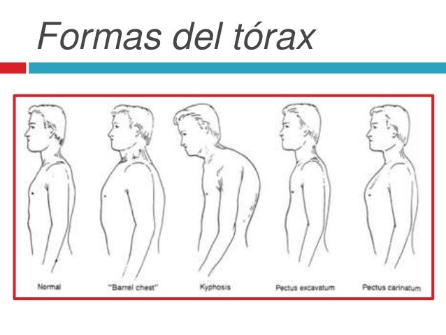 Semiología del tórax