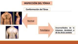 Semiología del Tórax.pptx