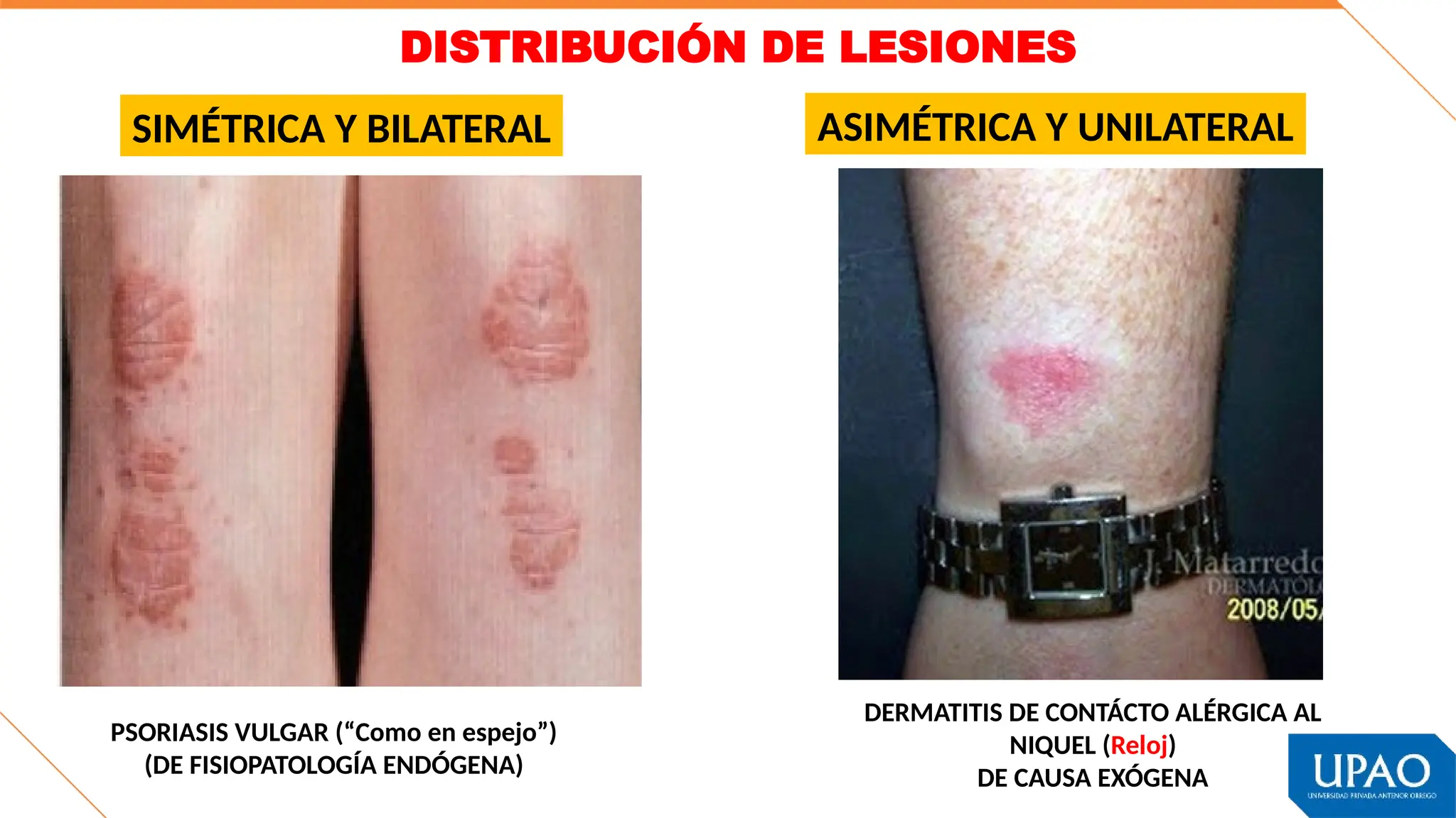 SEMIOLOGÍA DERMATOLÓGICA DE LA PIEL EX FISICA | PPTX