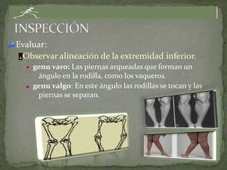 Semiología de rodilla 2 | PPTX