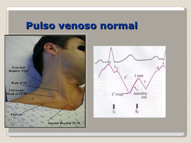 SEMIOLOGIA SIGNOS VITALES