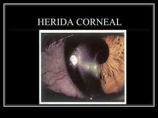 Semiología de trauma ocular | PPT