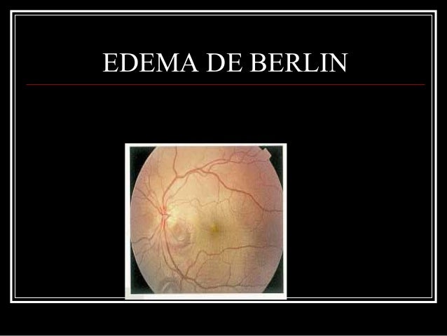 Semiología de trauma ocular
