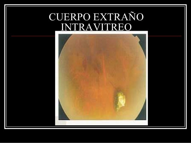 Semiología de trauma ocular