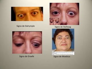Semiología endocrino | PPTX