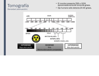 Semiología_Radiológic, características generales de la radiología | PDF