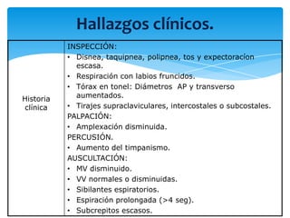 SEMIOLOGÍA RESPIRATORIA. II. DR. CASANOVA | PPTX