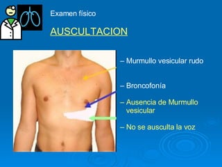 Semiologia De Torax Unssa | PPT