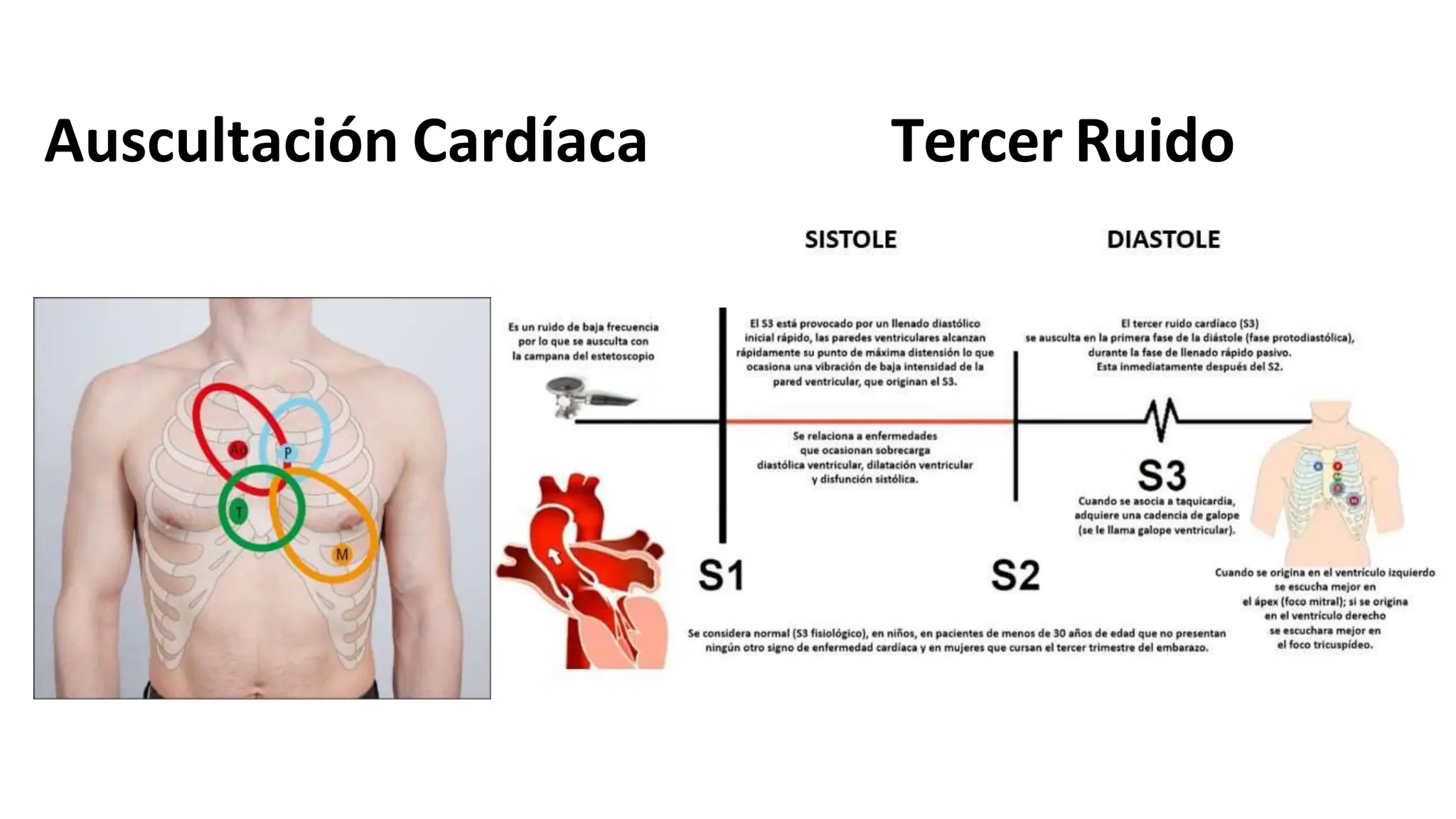 SEMIOLOGIA INSUFICIENCIA CARDIACA CARDIOLOGIA | PPTX | Heart and ...