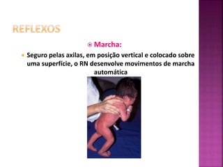 Semiologia neonatal | PPTX