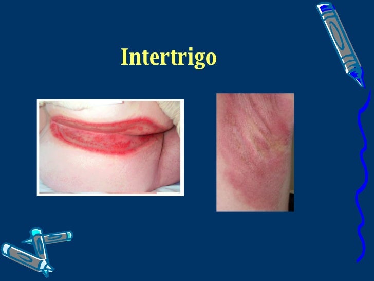 Semiologia Piel Y Anexos