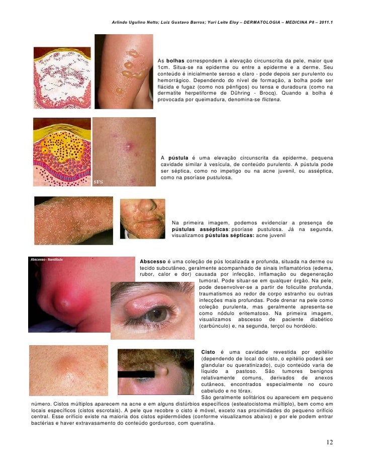 Semiologia 10 dermatologia - semiologia dermatológica pdf