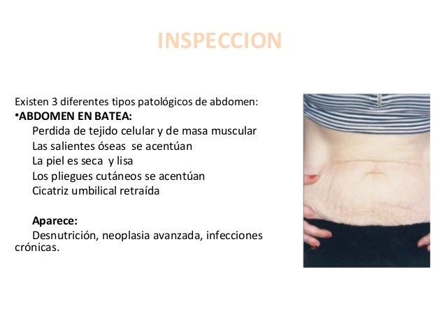 Semiologia abdomen