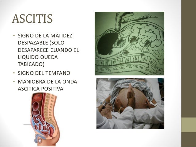 Semiologia Abdominal. Dr. Gonzalo Nieto