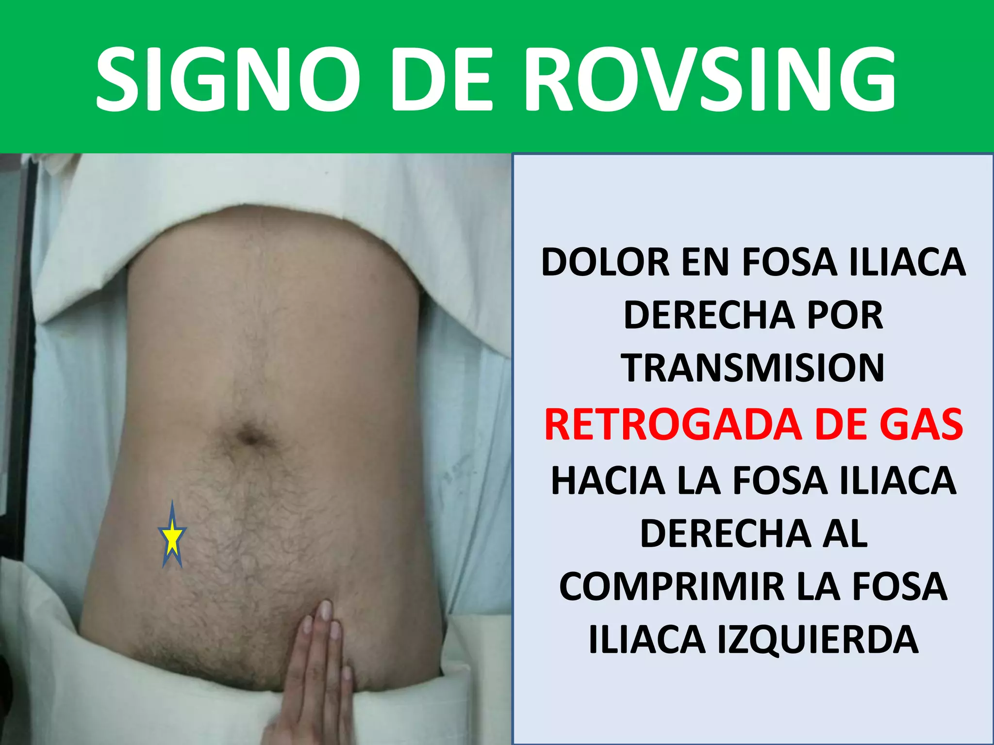 Semiologia de abdomen-220594