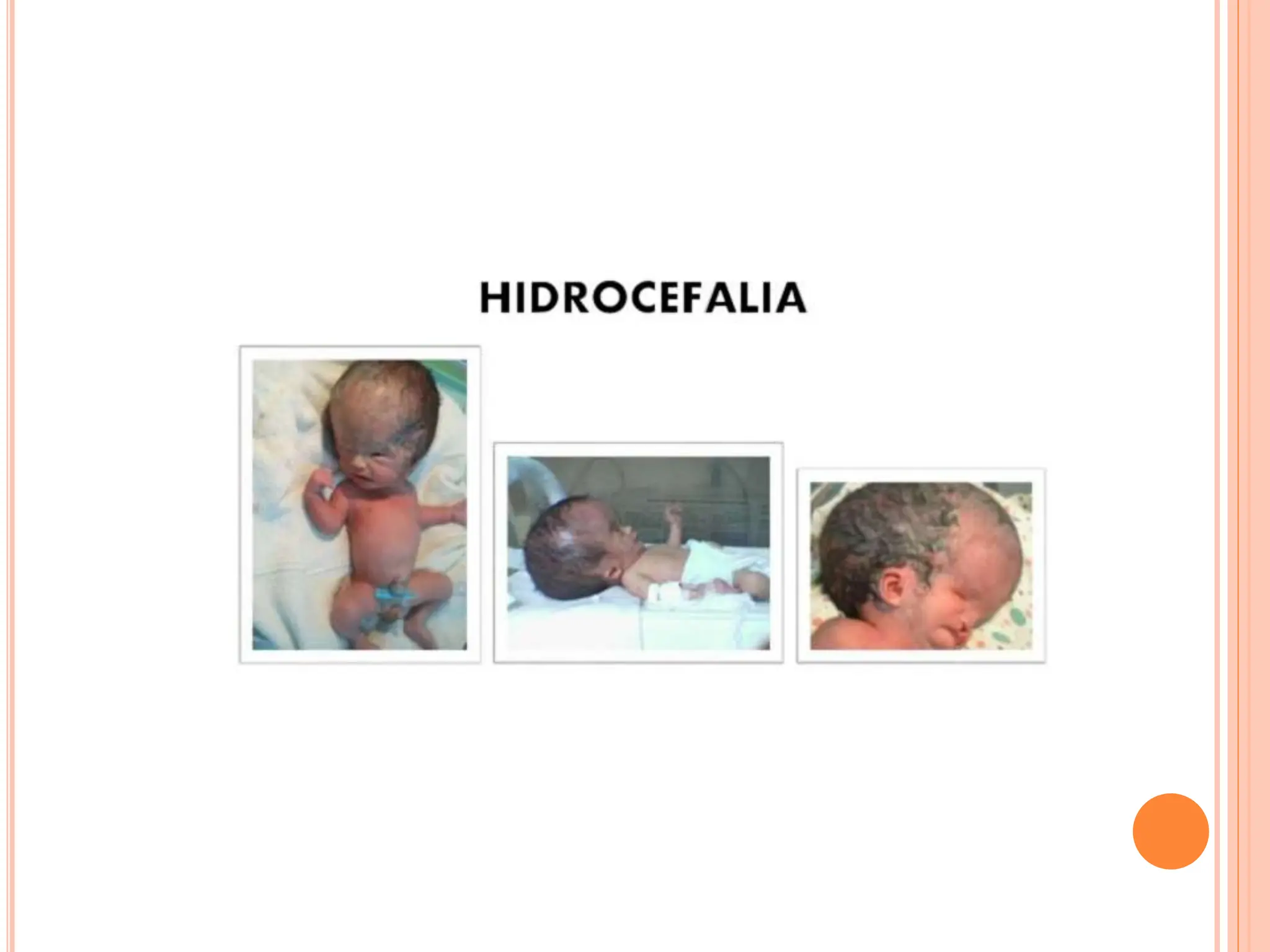 SEMIOLOGIA DE CABEZA Y CUELLO 2024-1.pptx
