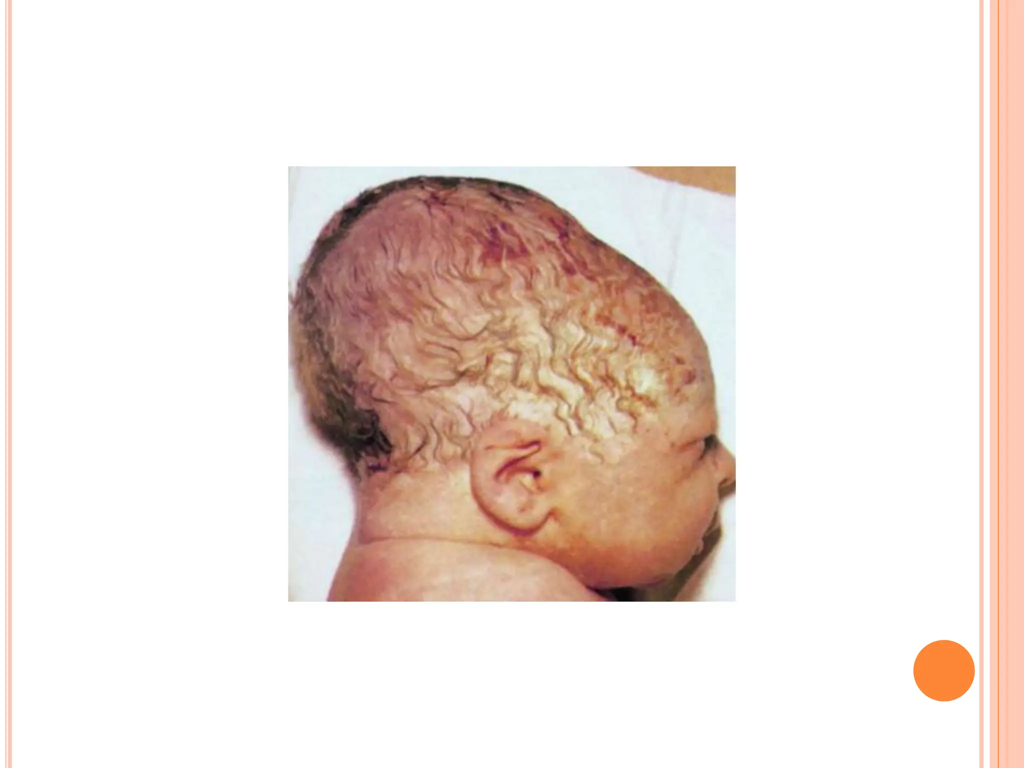 SEMIOLOGIA DE CABEZA Y CUELLO 2024-1.pptx