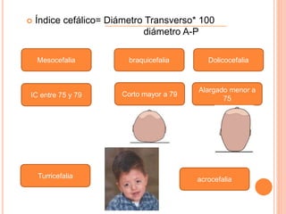 SEMIOLOGIA DE CABEZA Y CUELLO 2024-1.pptx