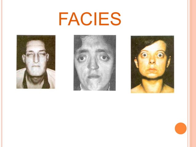 SEMIOLOGIA DE CABEZA Y CUELLO 2024-1.pptx