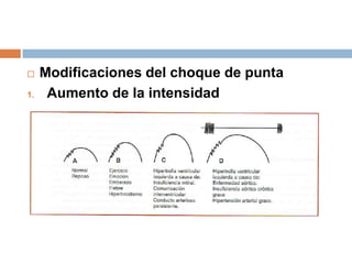 Semiologia cardiaca: inspeccion, papacion, percusion y auscultacion | PPTX