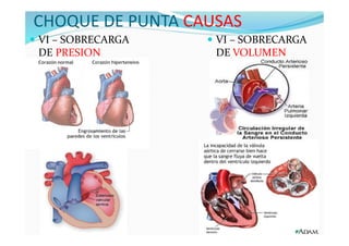 Semiologia cardiovascular | PDF