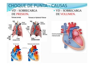Semiologia cardiovascular | PDF