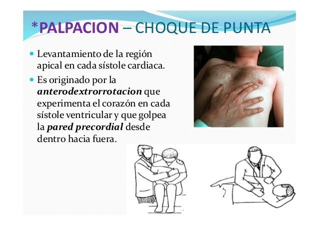 Semiologia cardiovascular