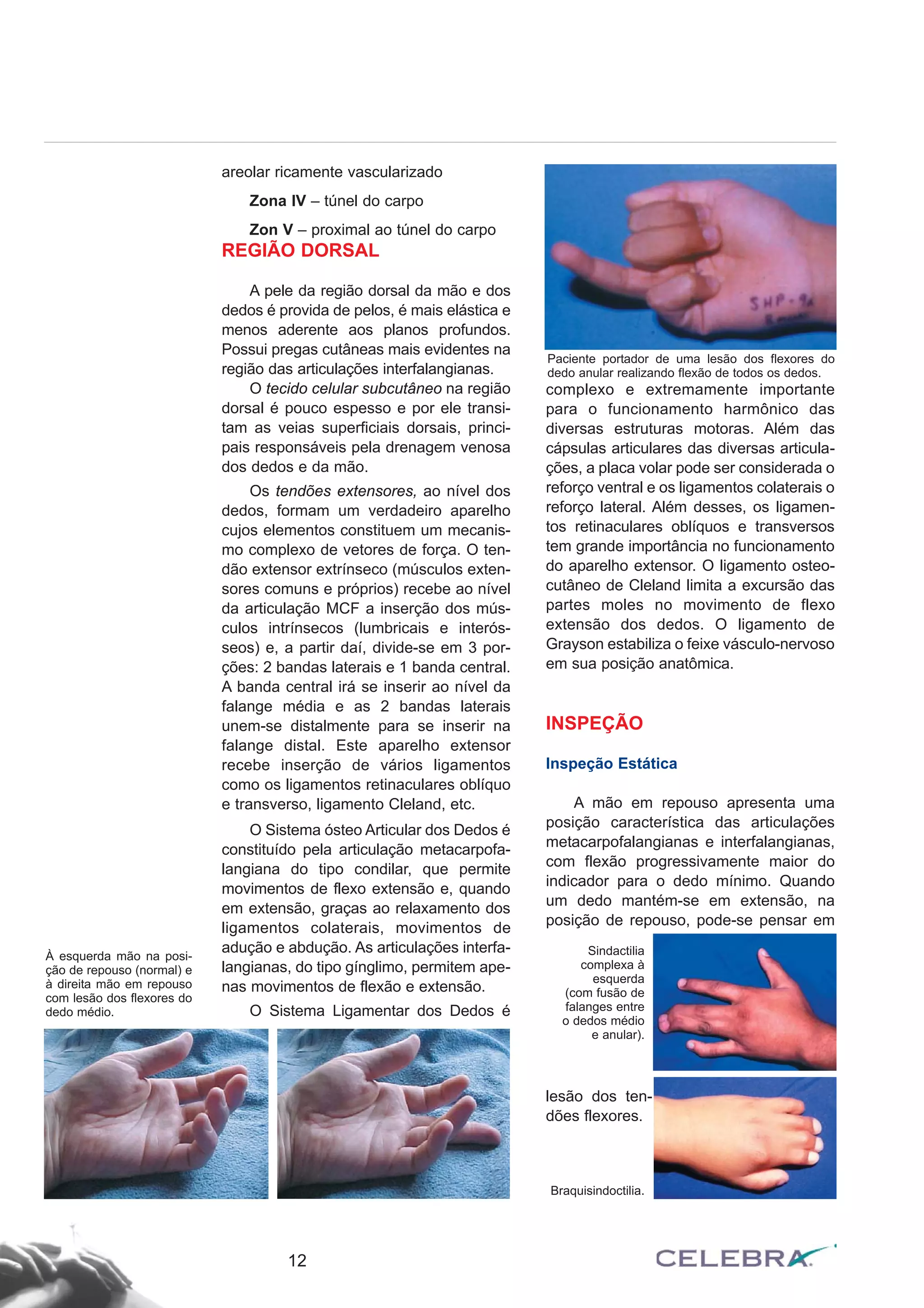 Semiologia da mão | PDF
