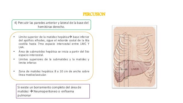 Semiologia de abdomen